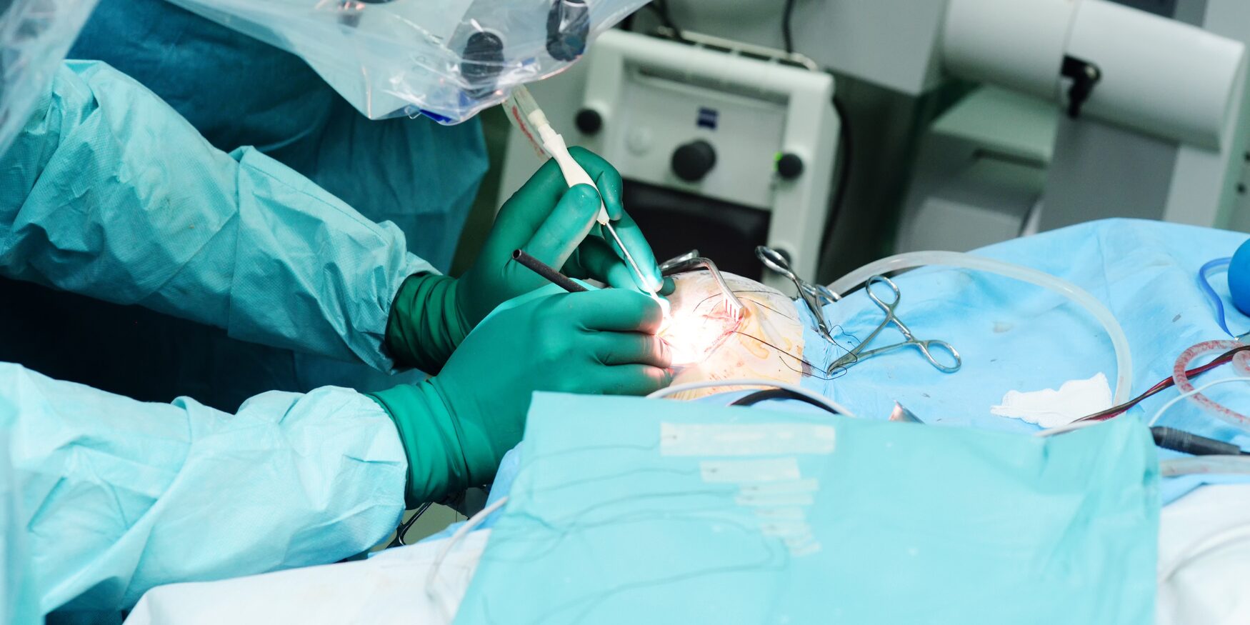 Endoscopic Third Ventriculostomy in Plano TX: A Minimally Invasive ...